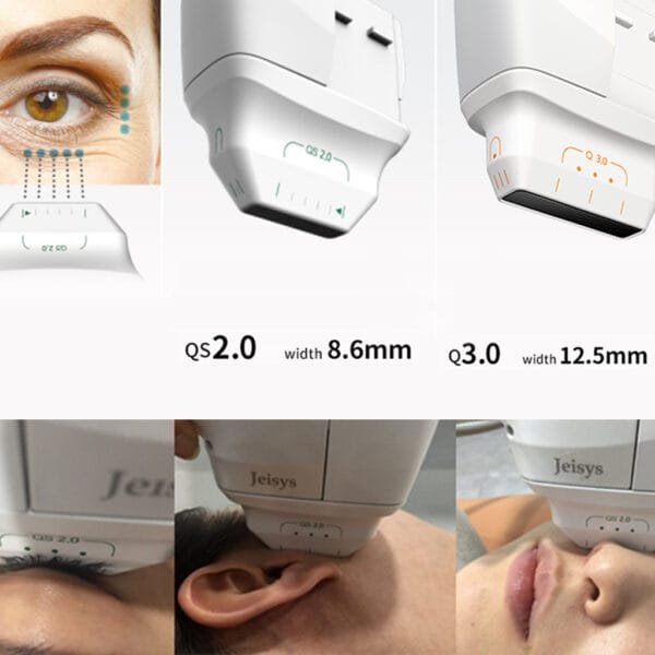 Hifu Treatment in South Delhi | HIFU Anti-Aging Treatment
